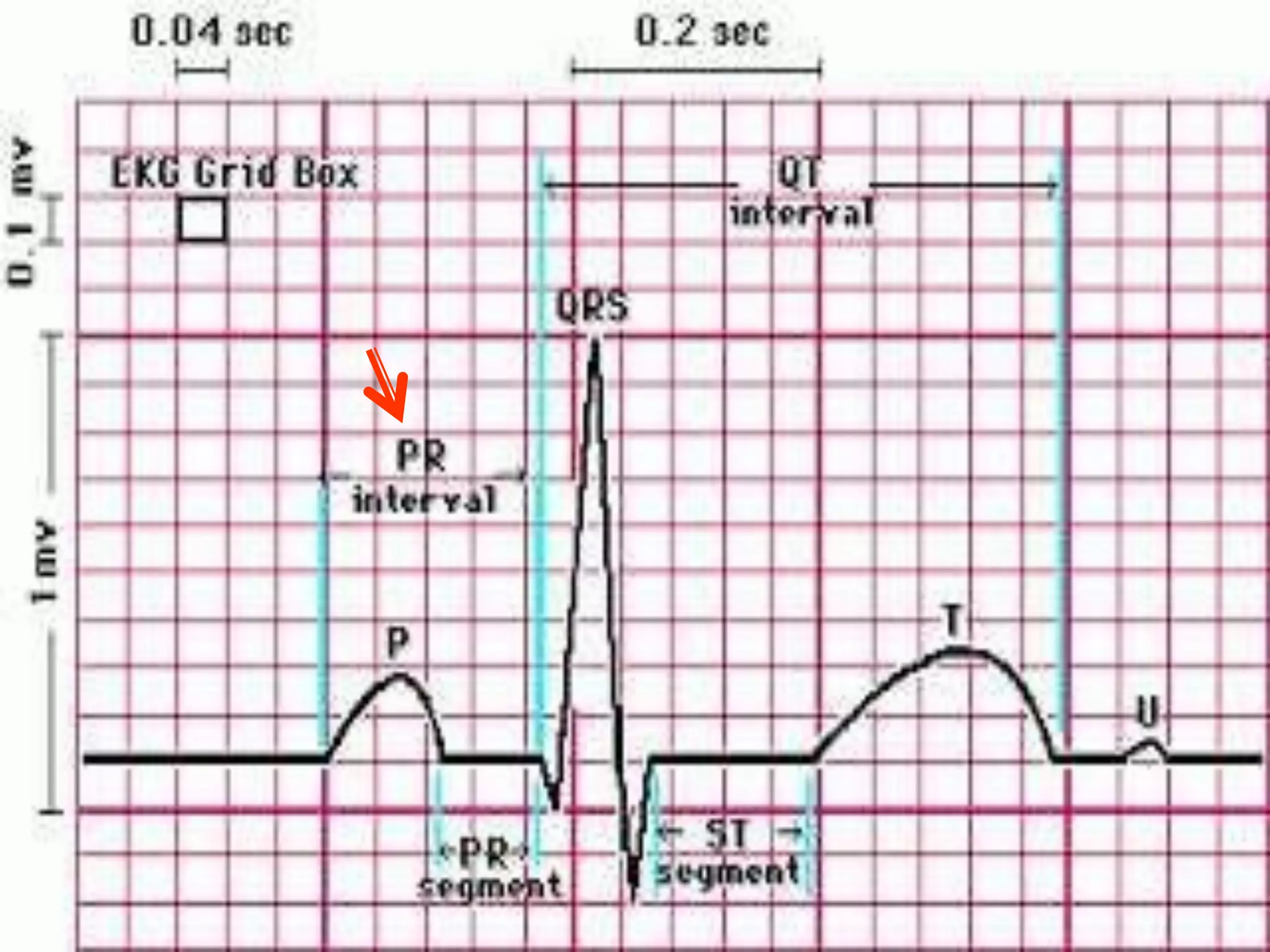 Modul Cara Praktis Membaca EKG.pdf