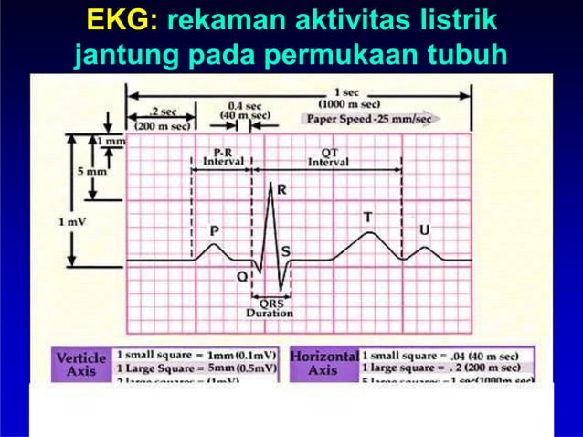 Modul Cara Praktis Membaca EKG.pdf