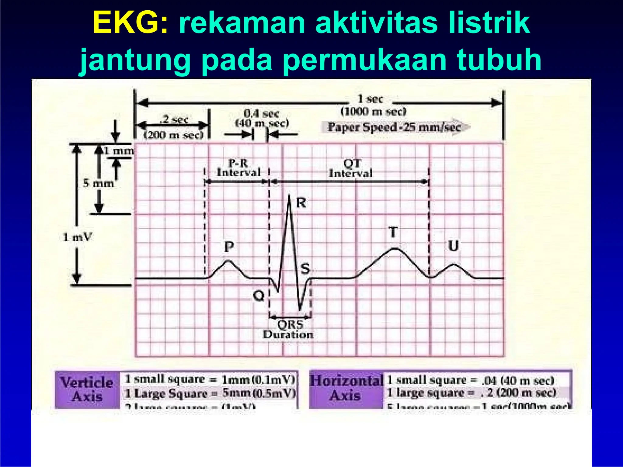 Modul Cara Praktis Membaca EKG untuk perawat dan nakes lain.pptx
