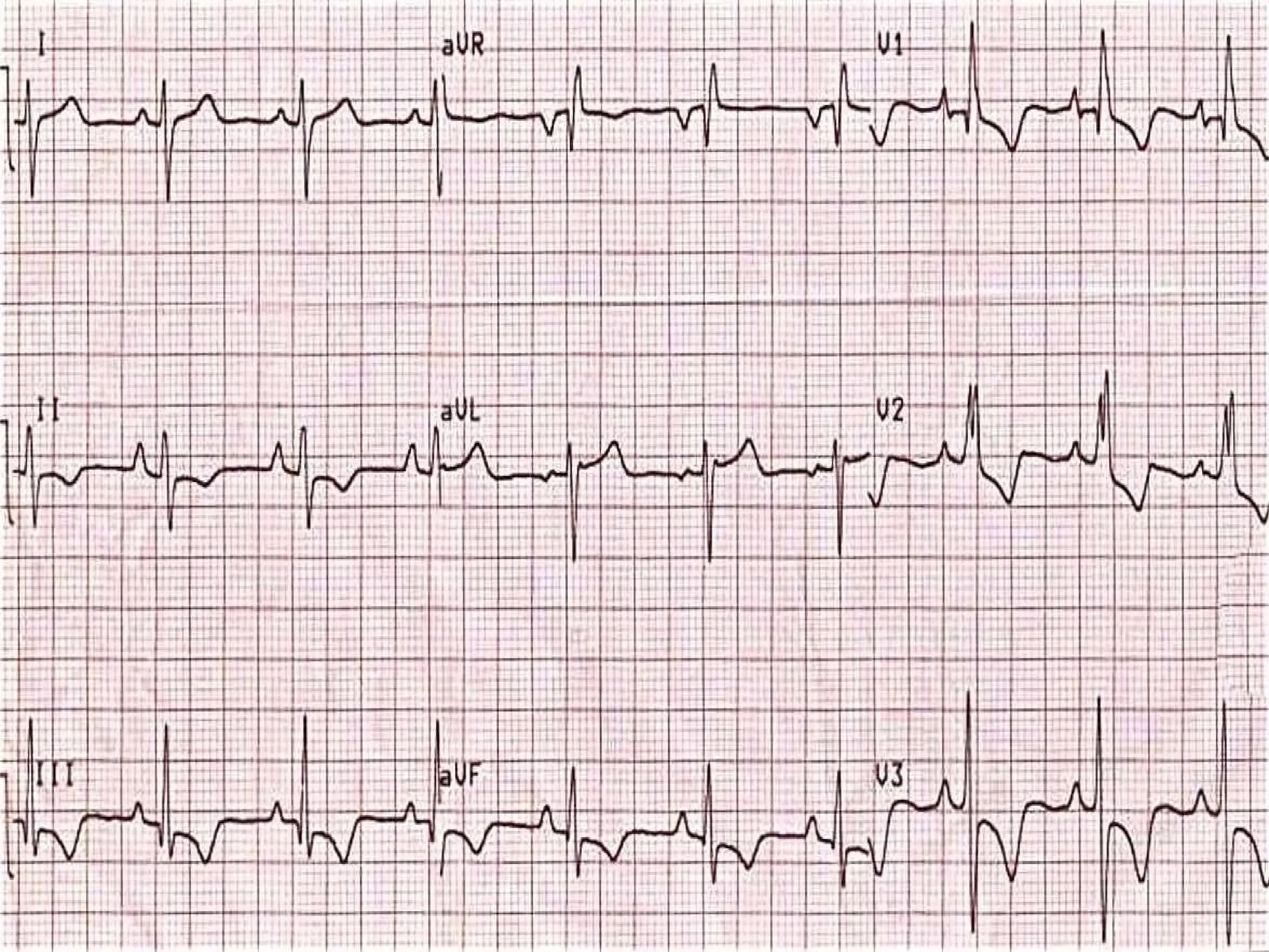 Modul Cara Praktis Membaca EKG untuk perawat dan nakes lain.pptx
