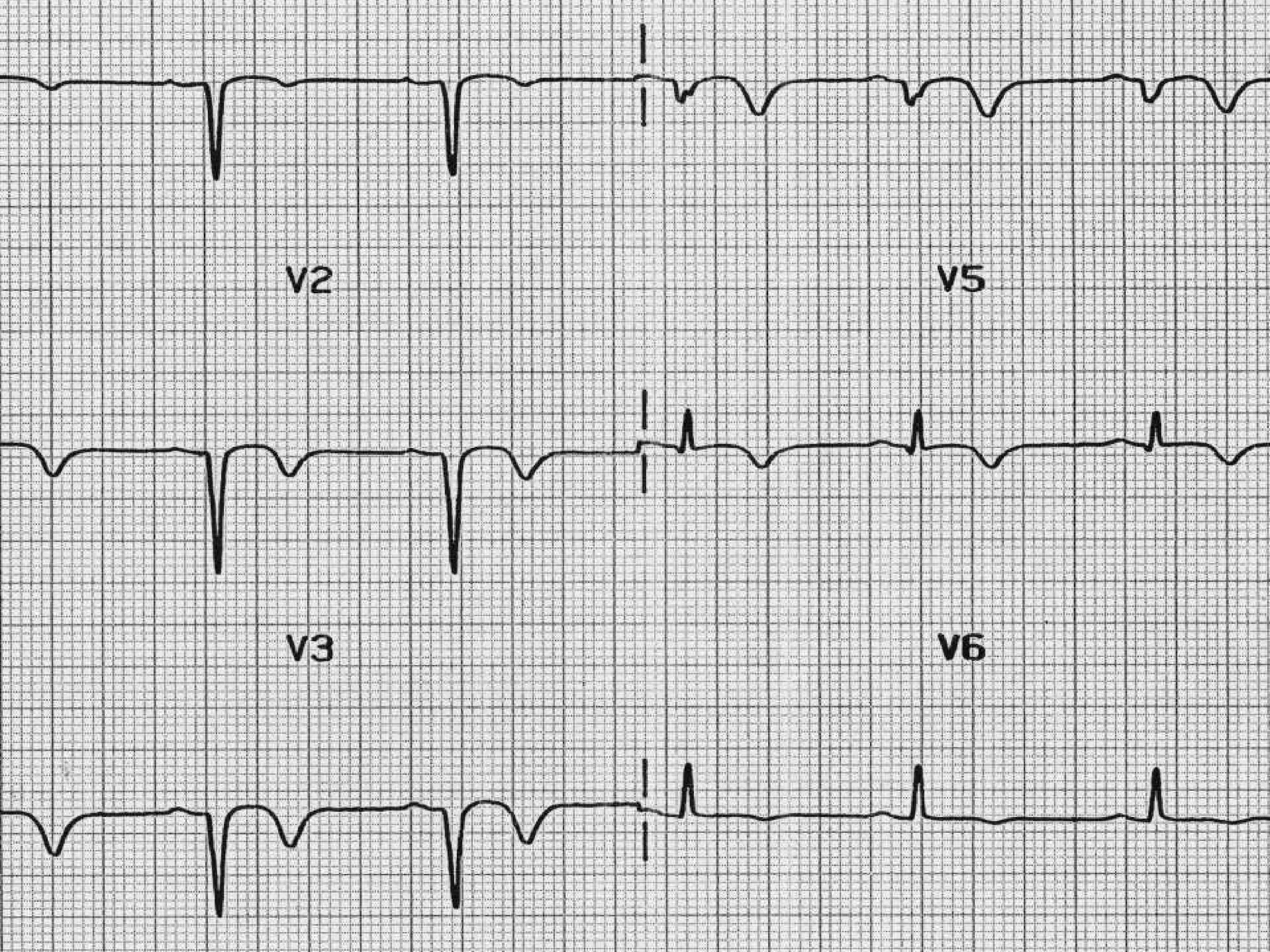 Modul Cara Praktis Membaca EKG untuk perawat dan nakes lain.pptx