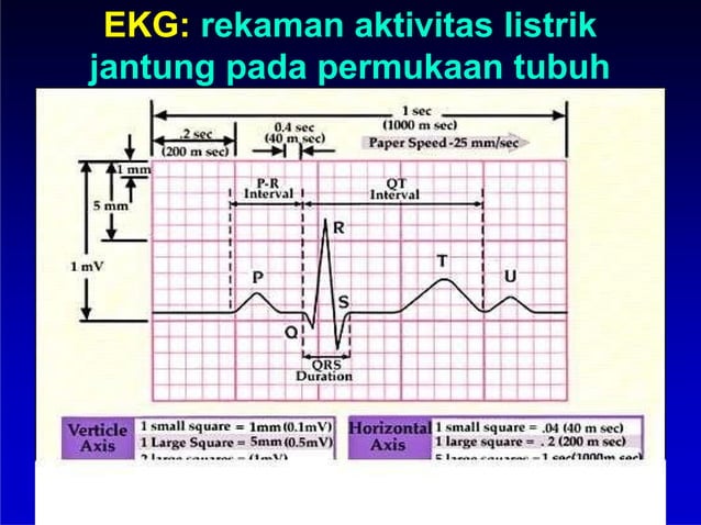 Modul Cara Praktis Membaca EKG untuk perawat dan nakes lain.pptx