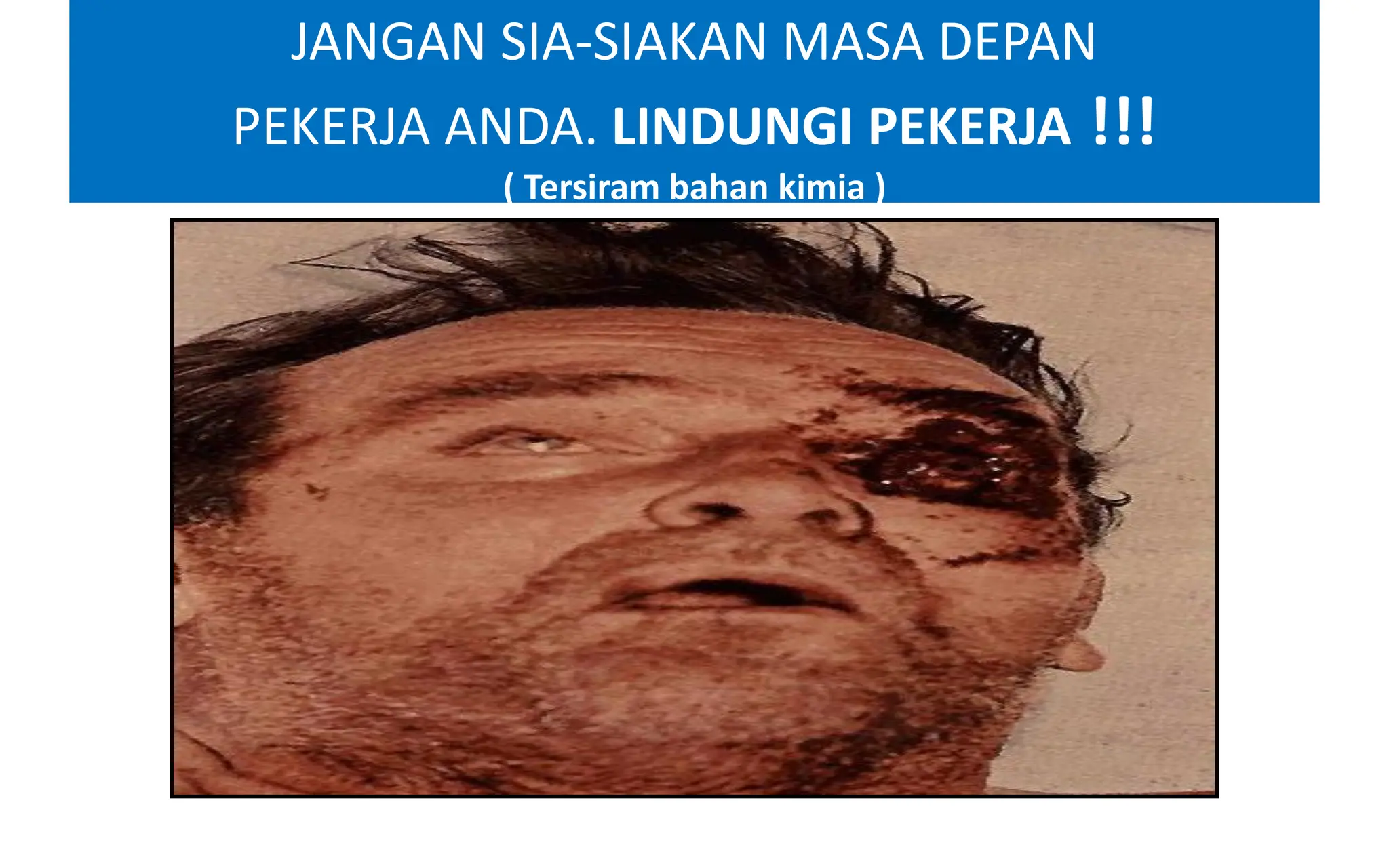 Modul Dasar K3 Umum penerapan keselamata kerja | PPT