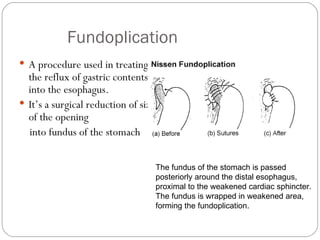 Module 2 Anatomy & Diseases | PPT