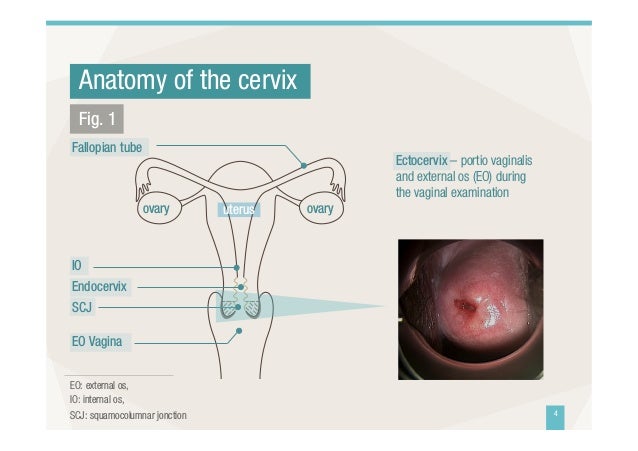 anatomy of transformation zone.pdf