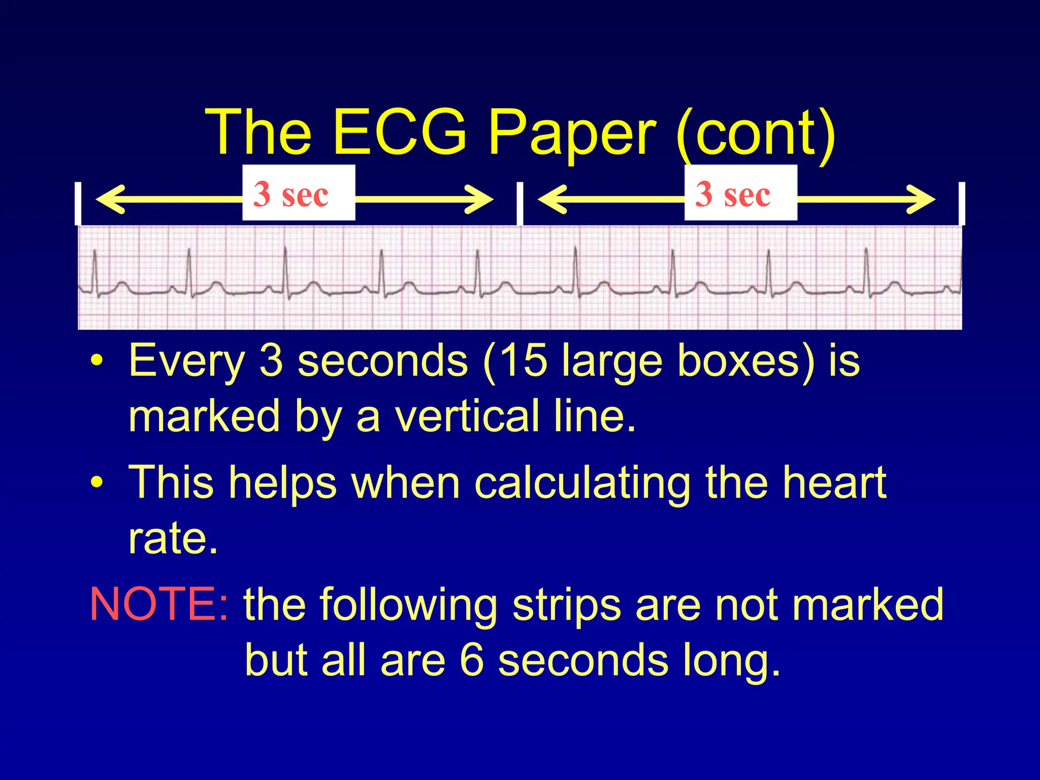 ECG INTRODUCTION LECTURE FOR MEDICAL SCHOOL | PPT | Free Download