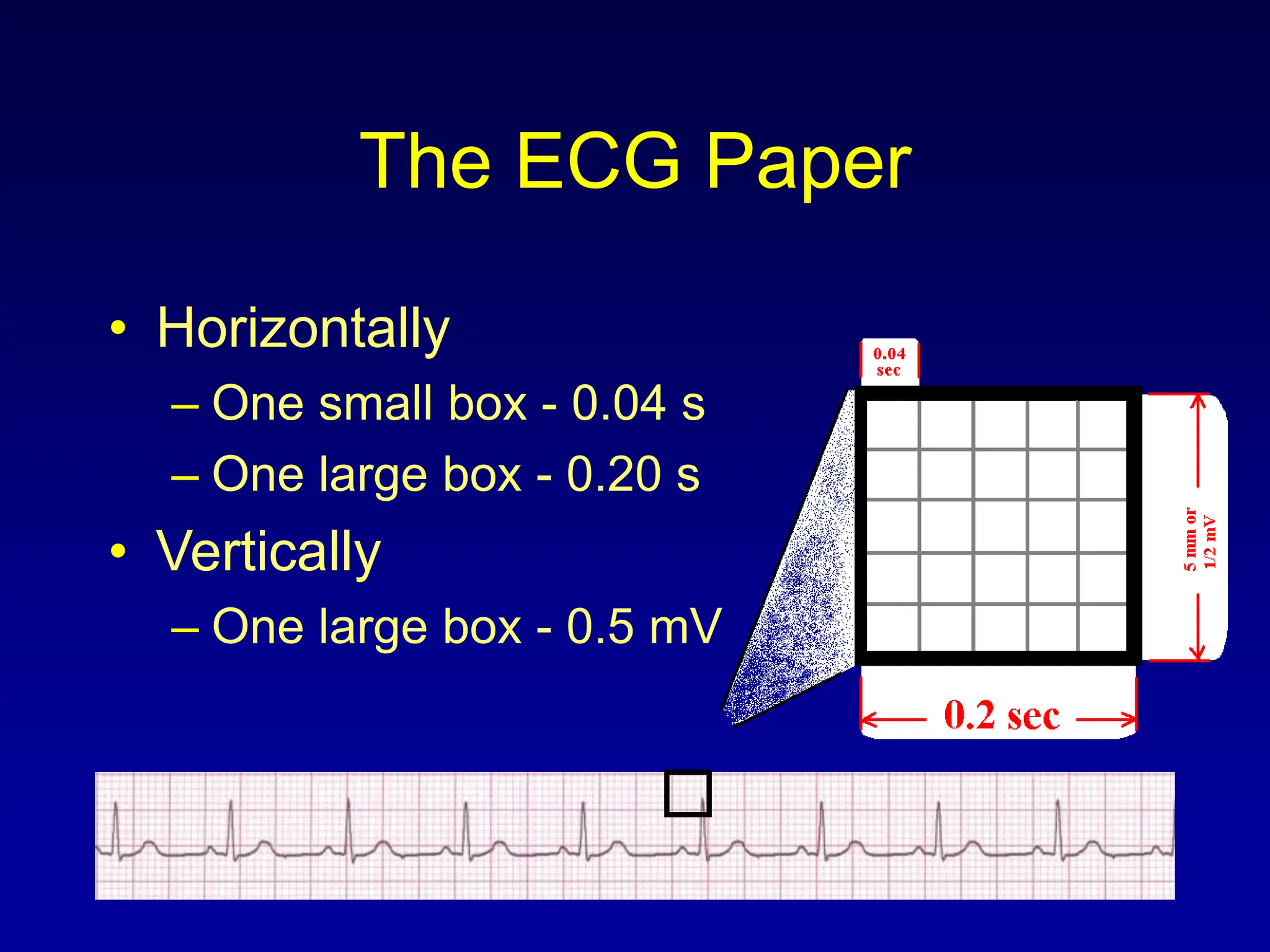 ECG INTRODUCTION LECTURE FOR MEDICAL SCHOOL | PPT