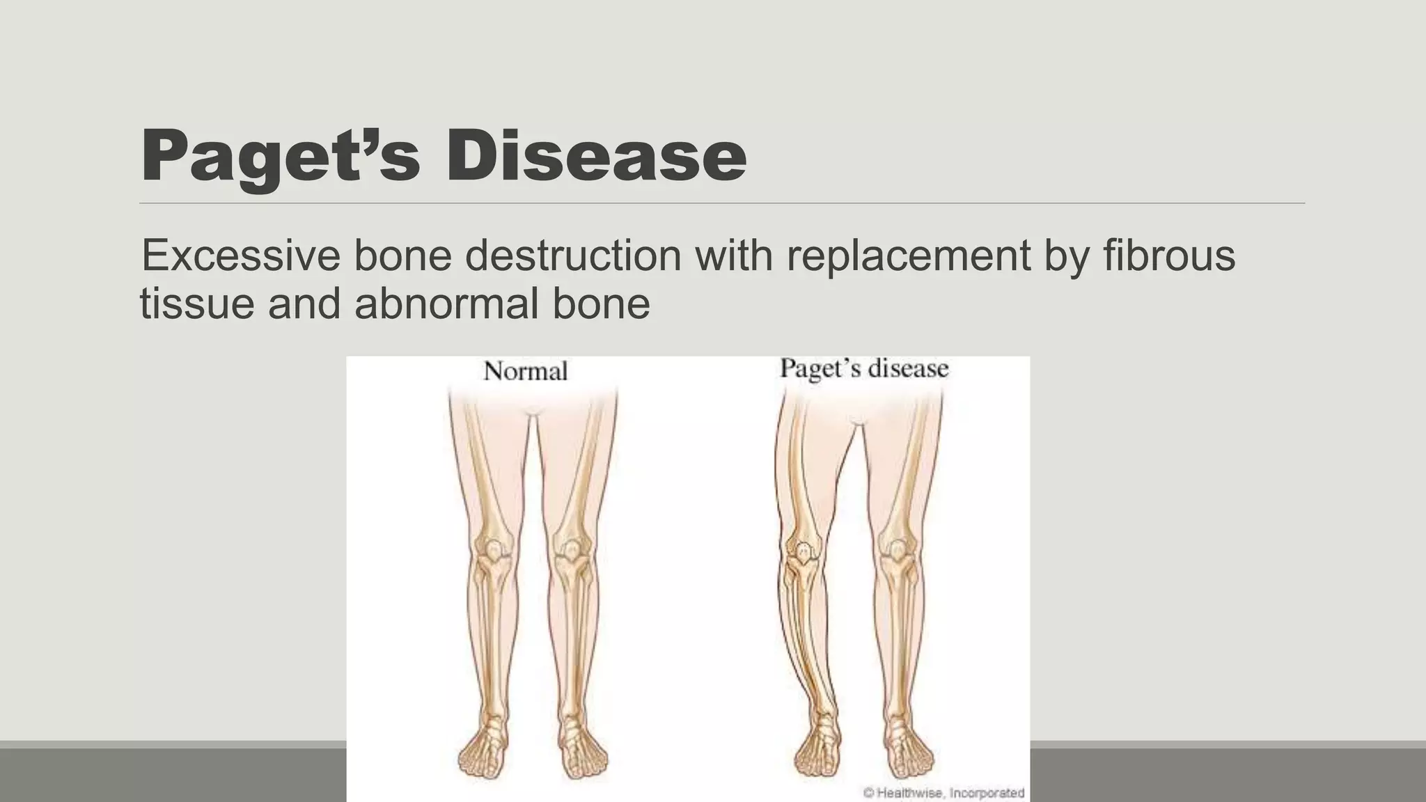 Musculoskeletal Pathophysiology | PPTX