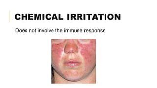 Integumentary Pathophysiology | PPTX