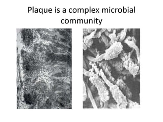Module 13 oral microbiology | PPTX