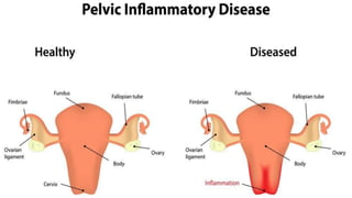 Male and Female Reproductive Pathophysiology | PPTX