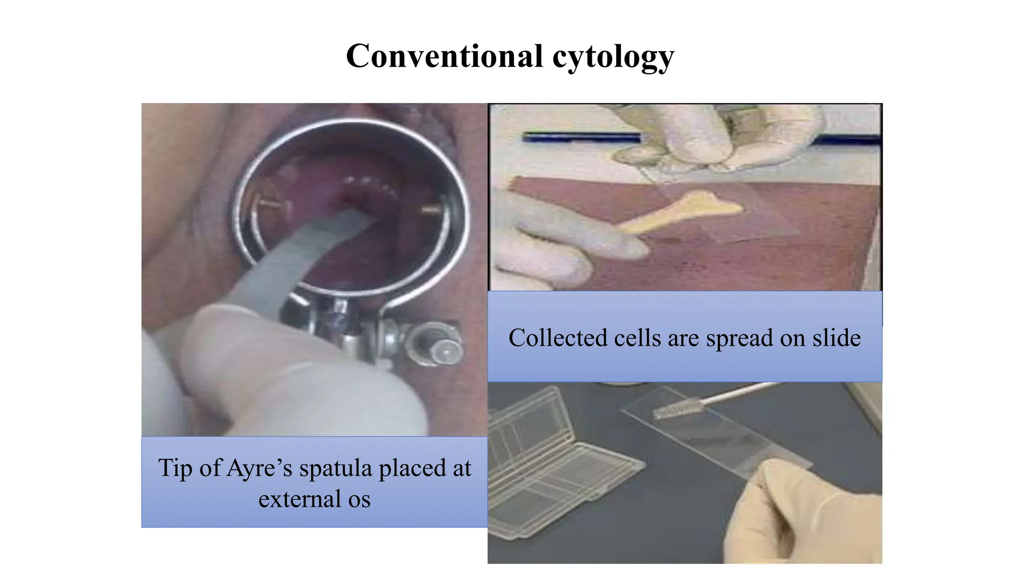 Module 1 Introduction to cervical cancer.pptx