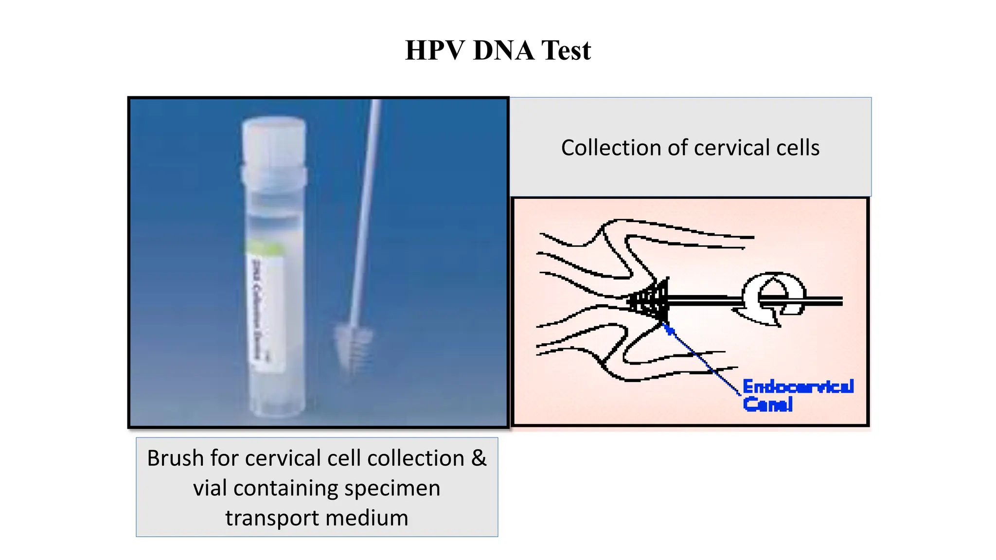 Module 1 Introduction to cervical cancer.pptx