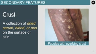 Module_1_Terminology.pdf terminology vvv | PPT