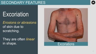 Module_1_Terminology.pdf terminology vvv | PPT