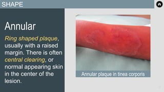 Module_1_Terminology.pdf terminology vvv | PPT