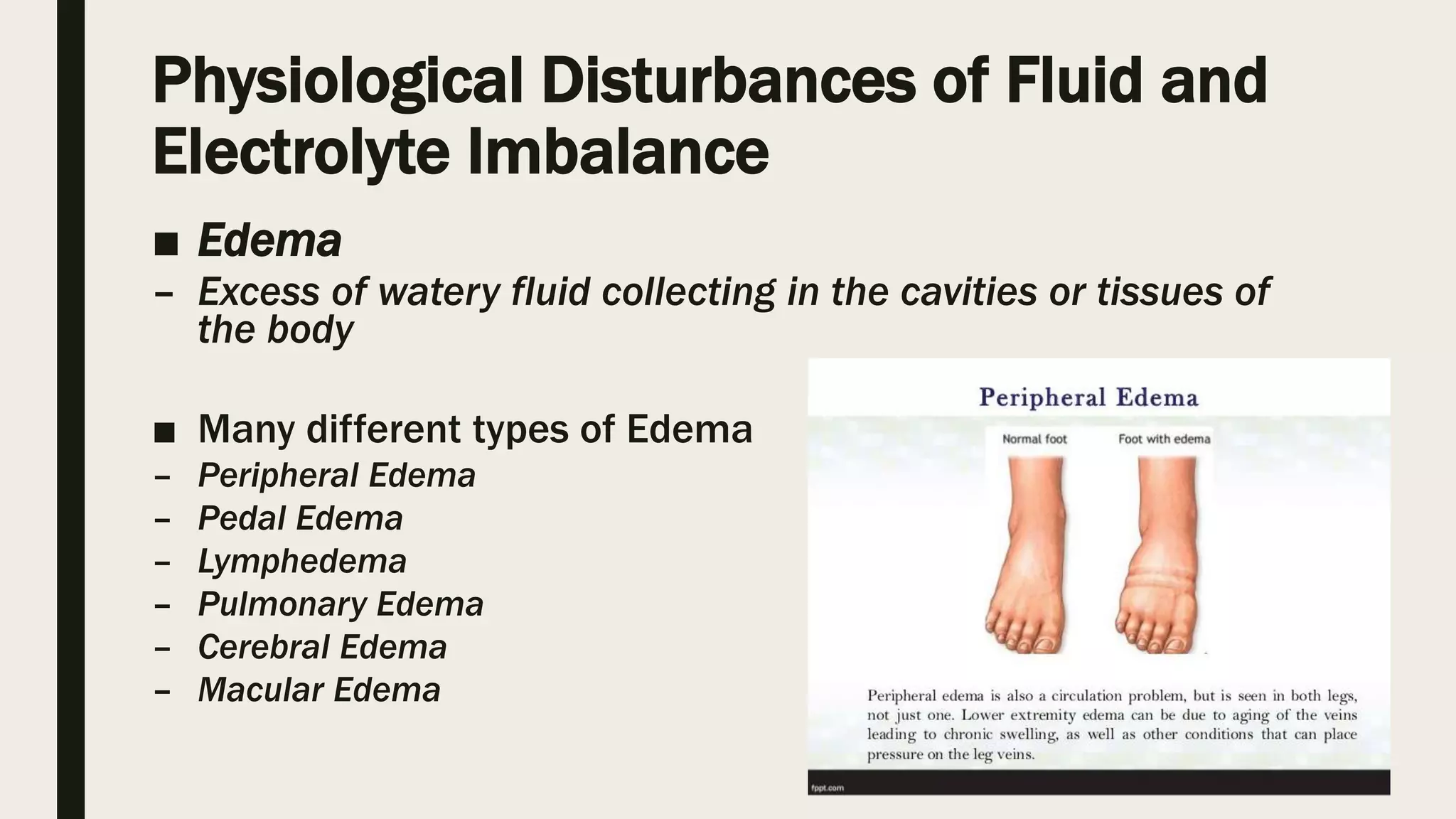 Pathophysiology: Fluid and Electrolyte Imbalance | PPTX