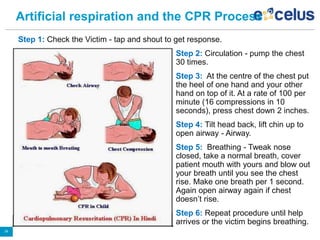 Module 2.pptx | First Aid | Injuries