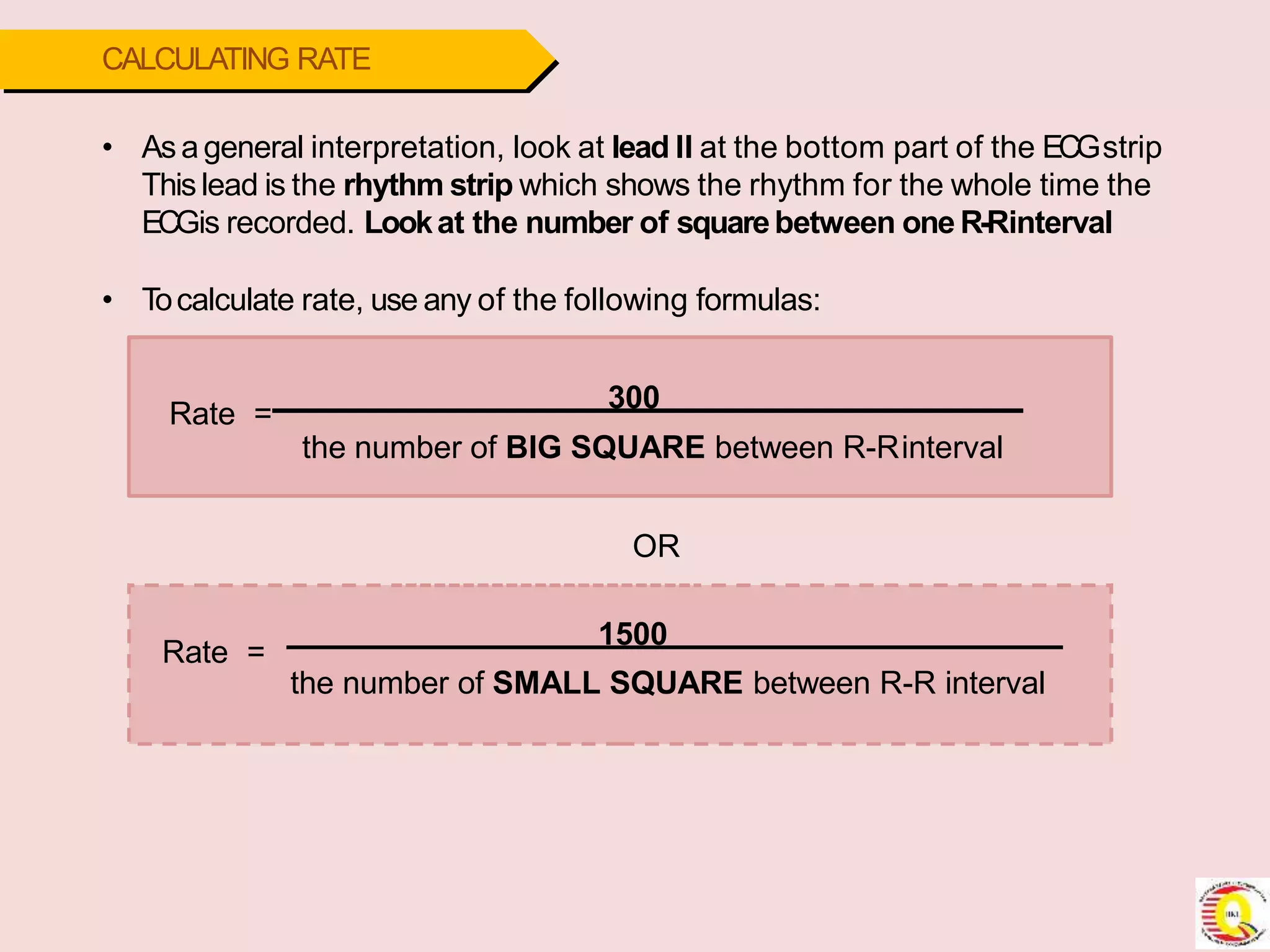 Module 2 interpreting ecg rythm strips-1-converted | PPTX