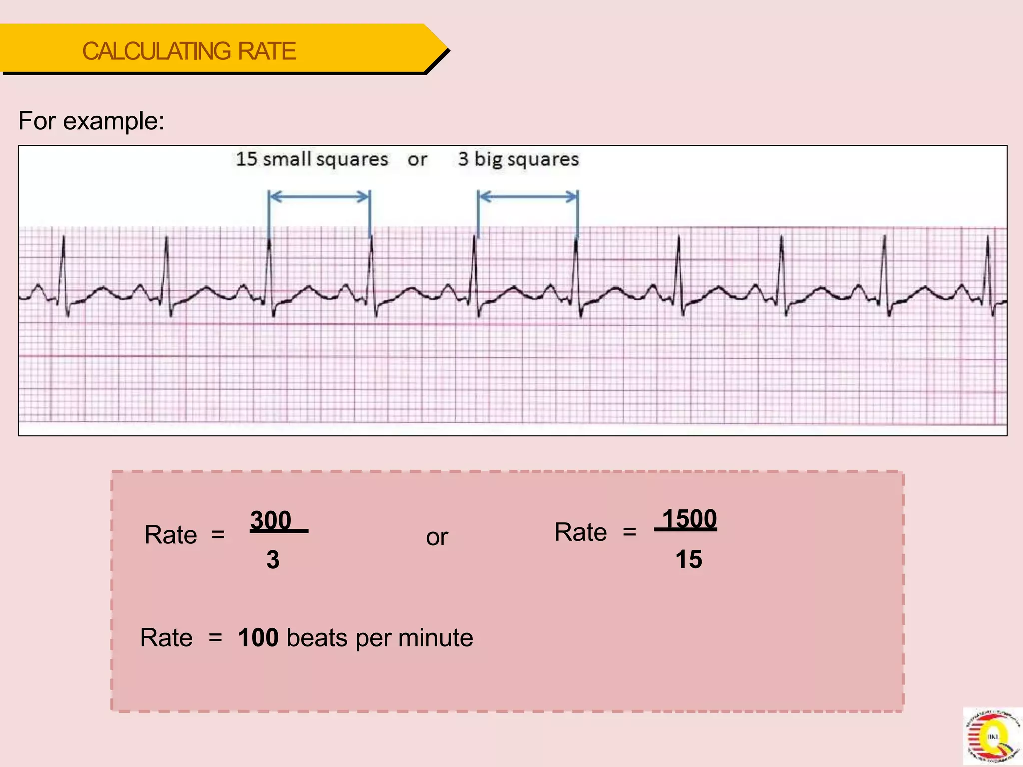 Module 2 interpreting ecg rythm strips-1-converted | PPTX