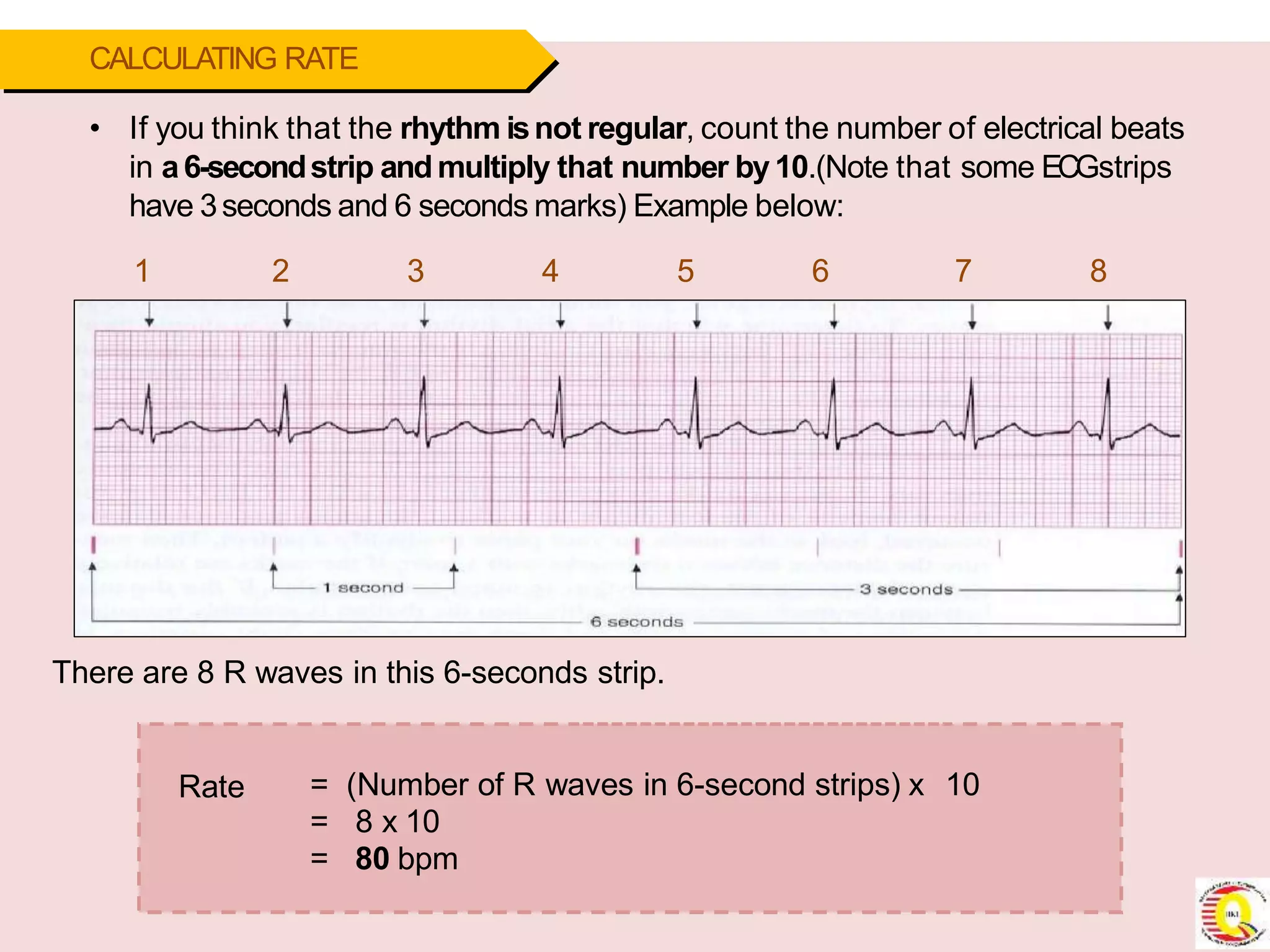 Module 2 interpreting ecg rythm strips-1-converted | PPTX