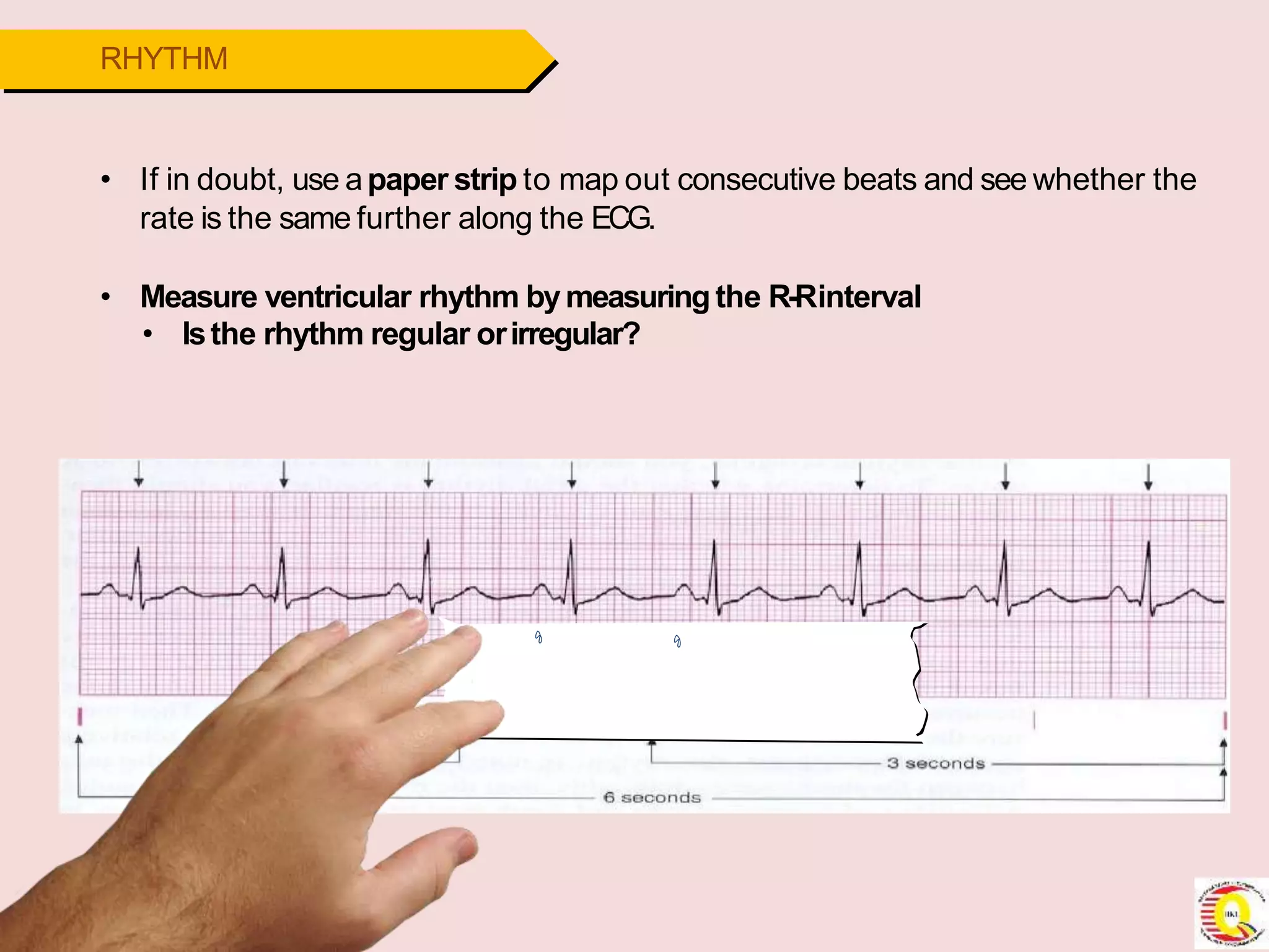 Module 2 interpreting ecg rythm strips-1-converted | PPTX
