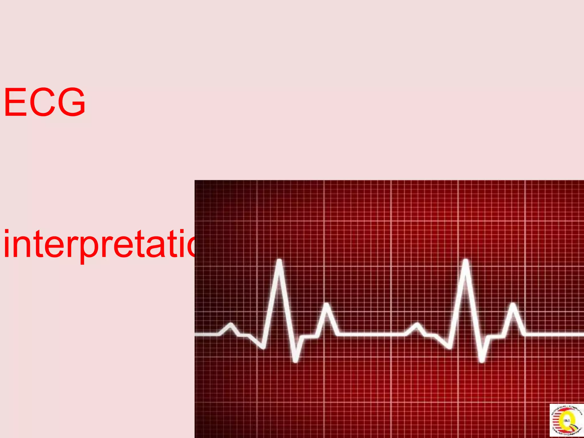 Module 2 interpreting ecg rythm strips-1-converted | PPTX