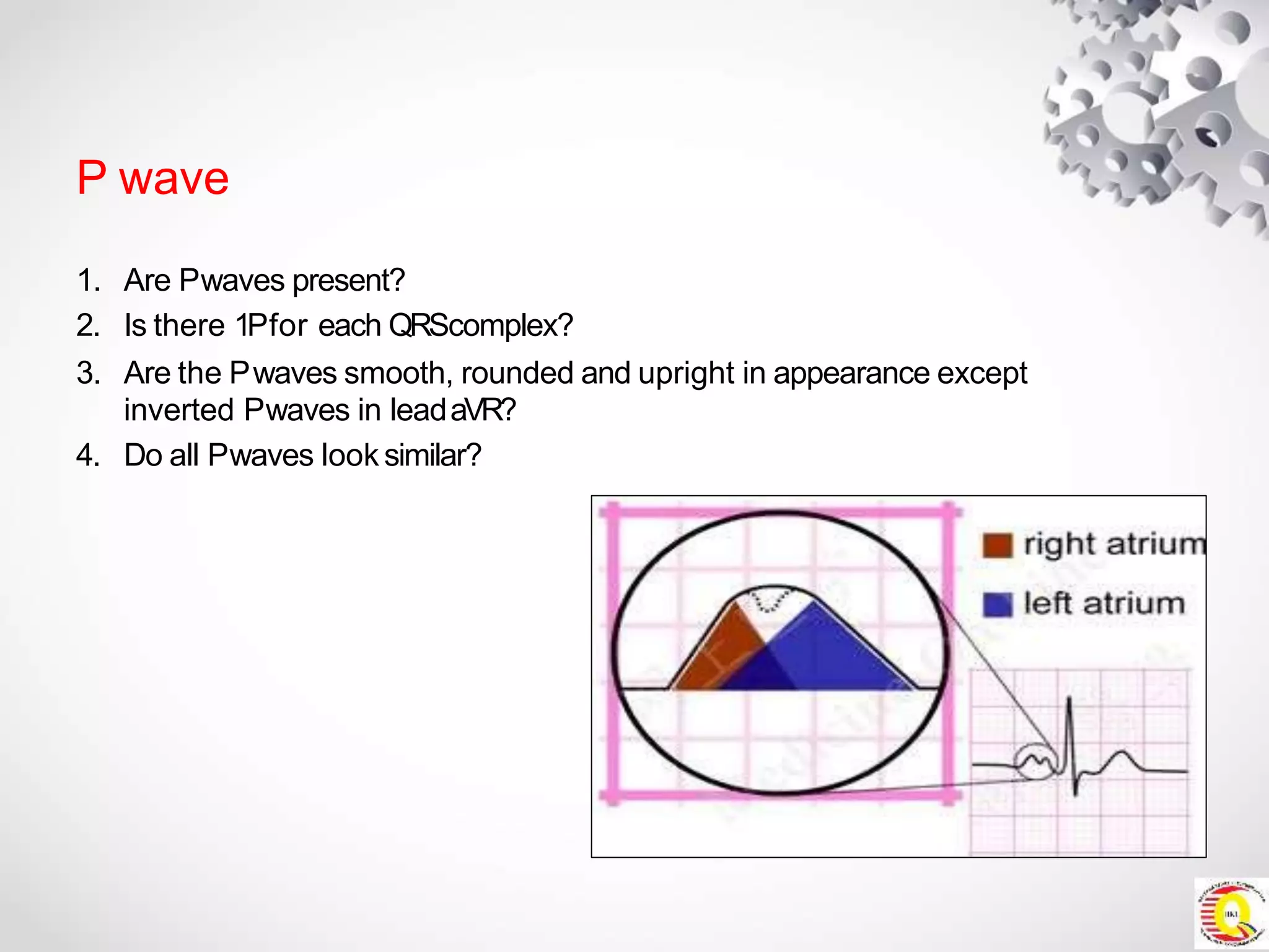 Module 2 interpreting ecg rythm strips-1-converted | PPTX