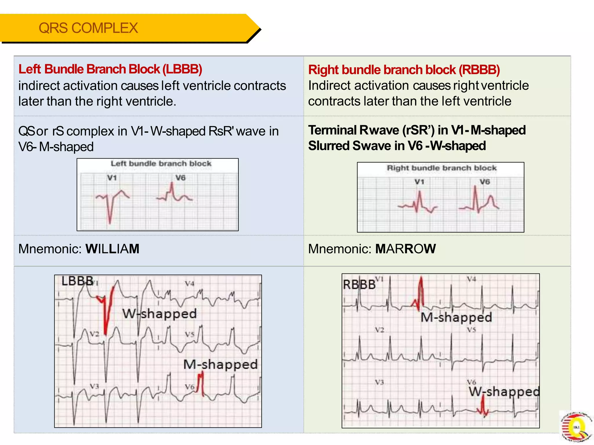 Module 2 interpreting ecg rythm strips-1-converted | PPTX