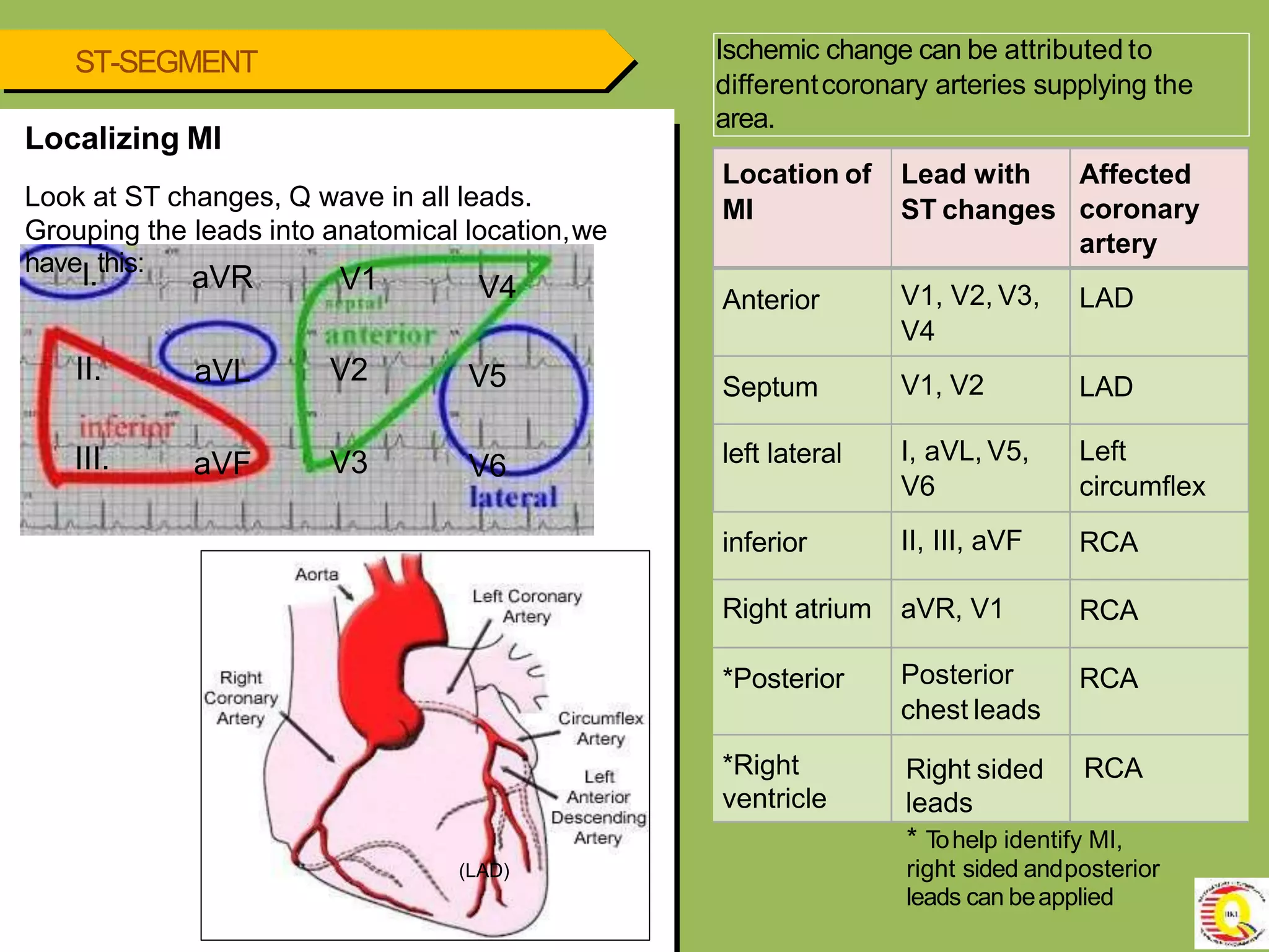 Module 2 interpreting ecg rythm strips-1-converted | PPTX