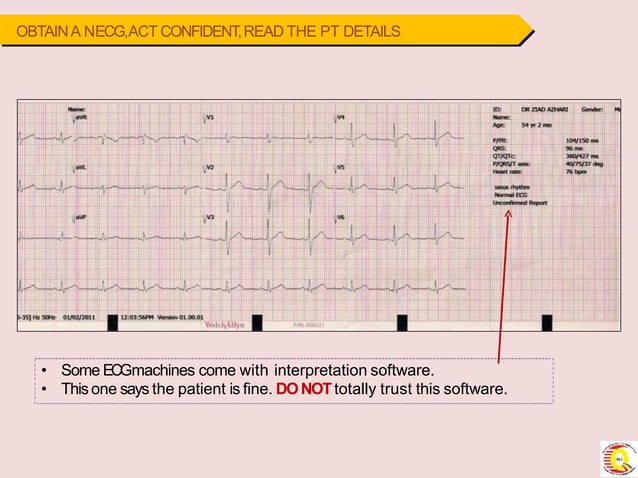 Module 2 interpreting ecg rythm strips-1-converted | PPTX