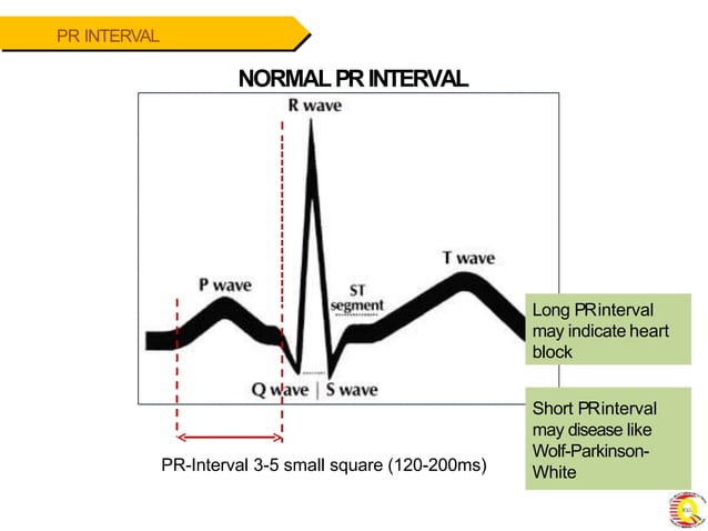 Module 2 interpreting ecg rythm strips-1-converted | PPTX