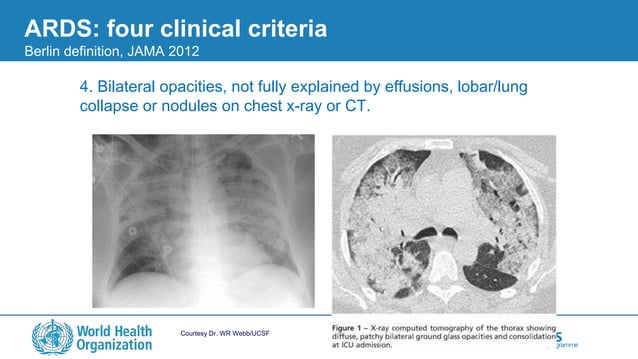SARI CRITICAL CARE TRAINING CLINICAL SYNDROMES | PDF
