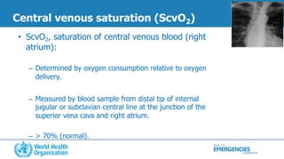 PATHOPHYSIOLOGY OF SEPSIS AND ARDS / SARI PATIENTS | PPT