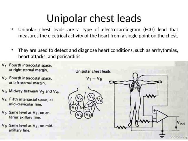 module 2_Part 1 (ECG) powerpoint pres.pptx