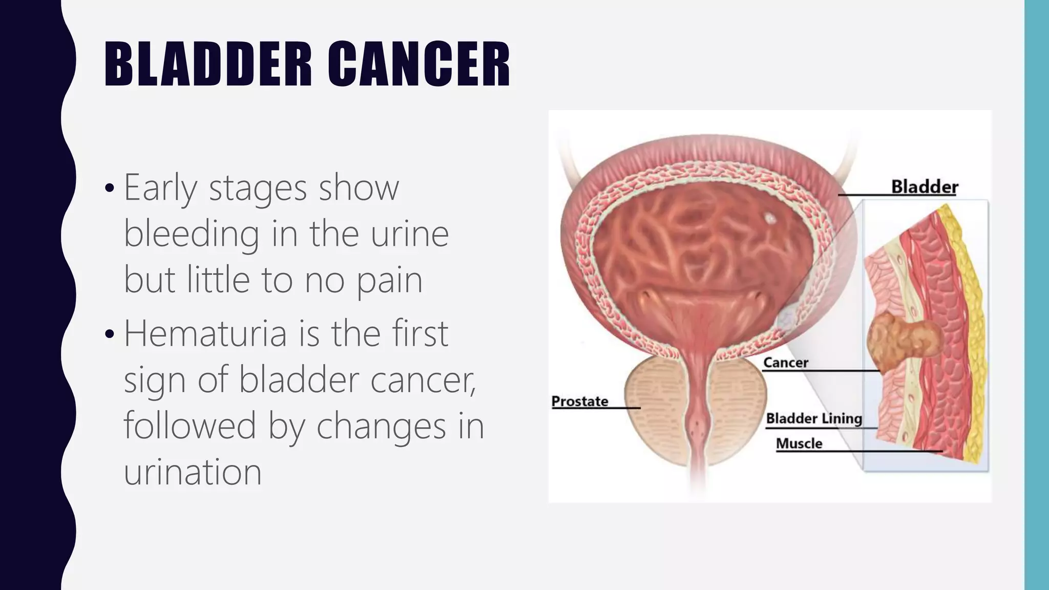 Pathophysiology: Cancer and Genetics | PPTX