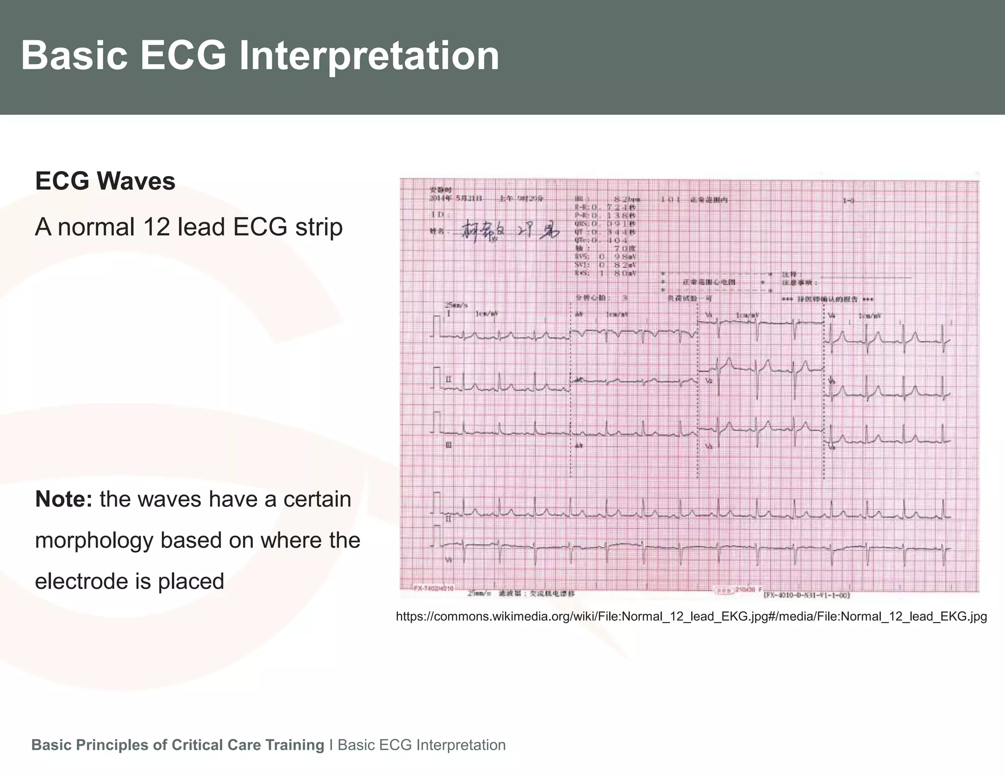 Module 3.6 Basic ECG Interpretation | PPTX