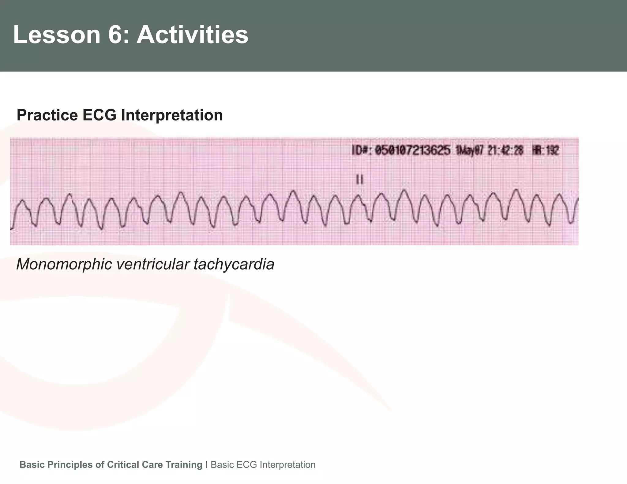 Module 3.6 Basic ECG Interpretation | PPTX
