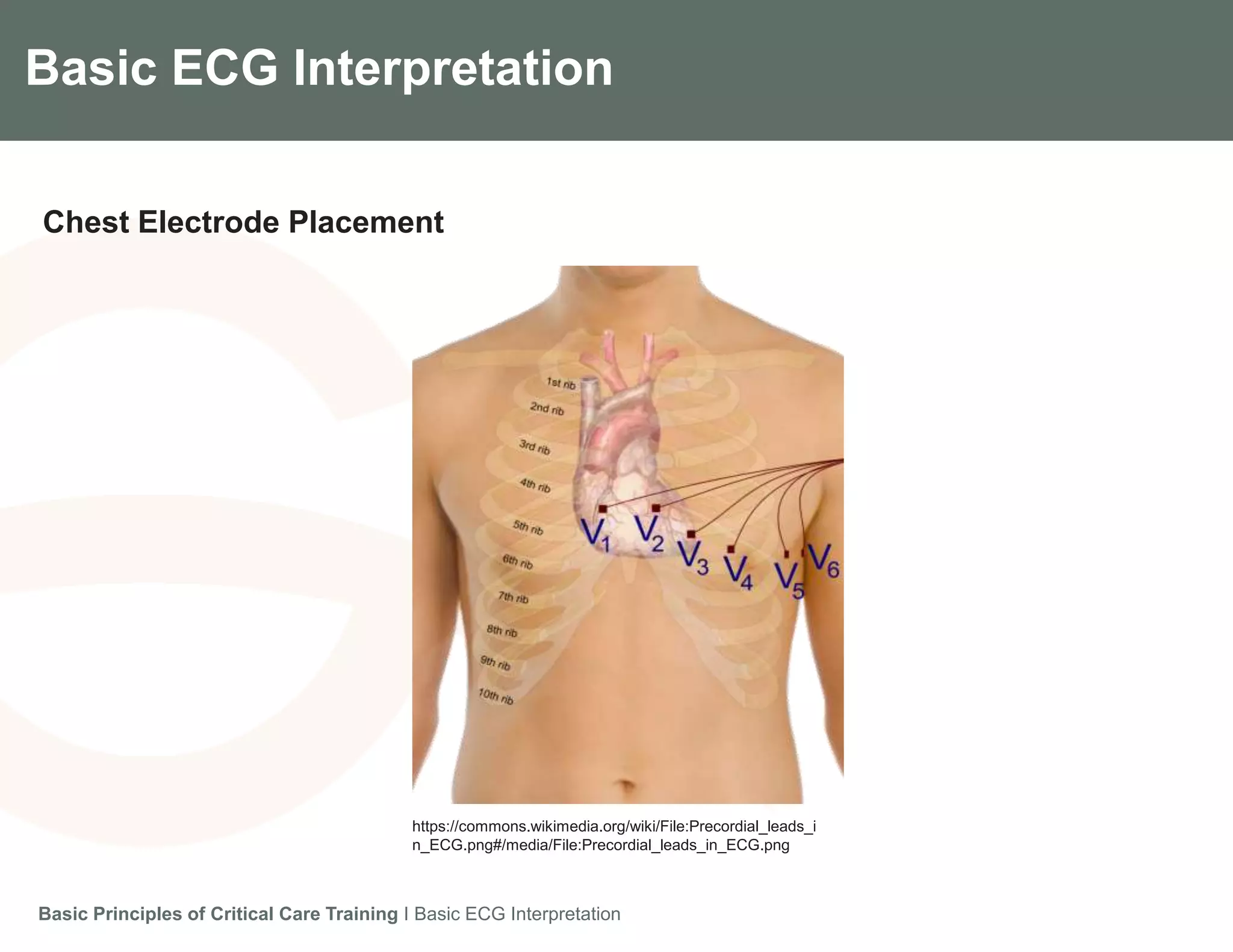 Module 3.6 Basic ECG Interpretation | PPTX