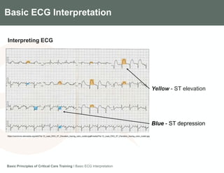 Module 3.6 Basic ECG Interpretation | PPTX
