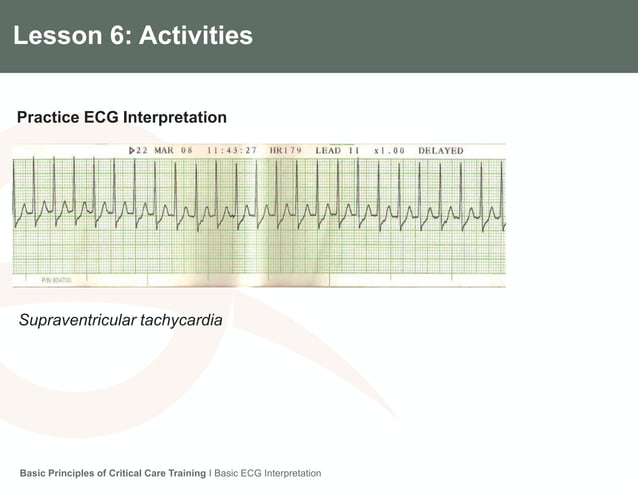 Module 3.6 Basic ECG Interpretation | PPTX