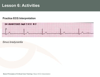 Module 3.6 Basic ECG Interpretation | PPTX