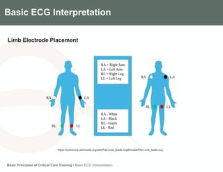 Module 3.6 Basic ECG Interpretation | PPTX