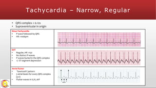 Module 3 peri arrest and arrest rhythm -1 | PPTX