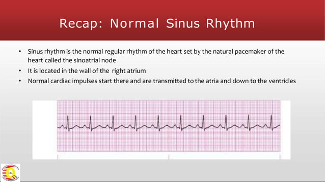 Module 3 peri arrest and arrest rhythm -1 | PPT