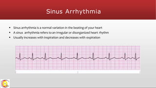 Module 3 peri arrest and arrest rhythm -1 | PPTX