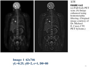 Digital Image Processing Module 3 Notess | PPT