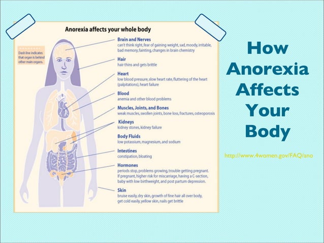 Medical Complications associated with Eating Disorders | PPT
