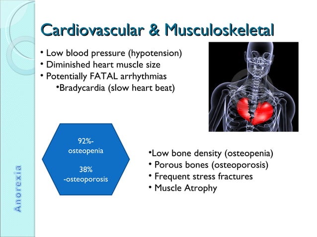 Medical Complications associated with Eating Disorders | PPT