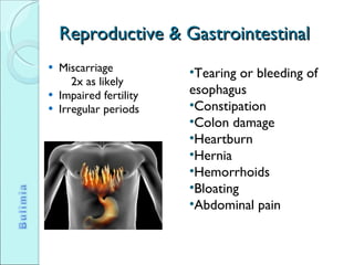 Medical Complications associated with Eating Disorders | PPT